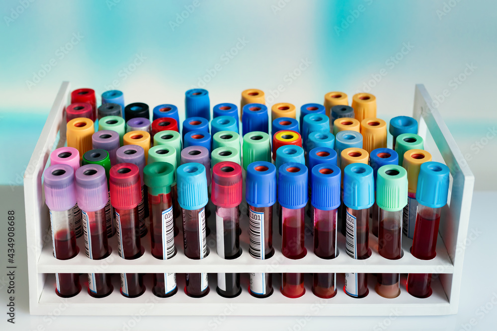 rack with tubes with blood samples taken from patients for analysis in ...
