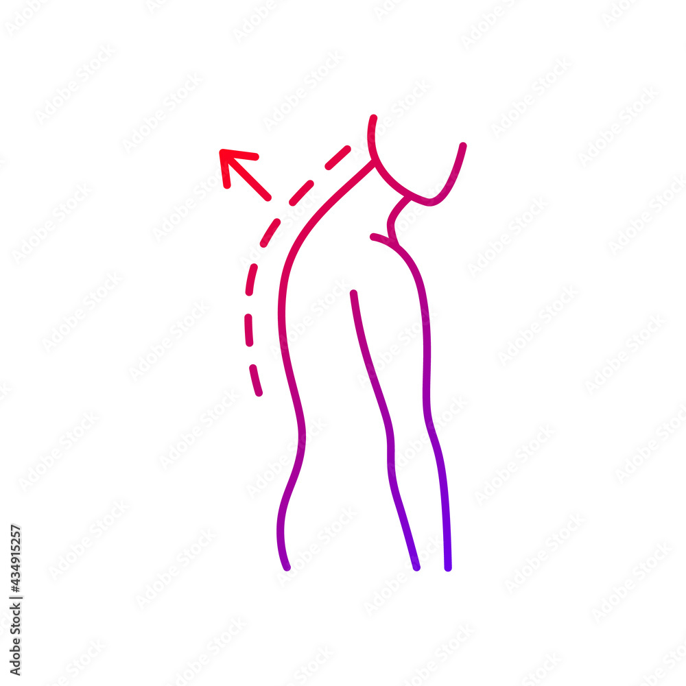 Thoracic kyphosis gradient linear vector icon. Prominent shoulder blade ...