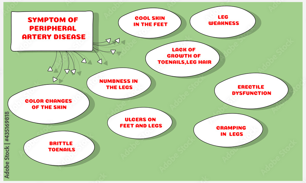 symptoms of peripheral artery disease. Vector illustration for medical ...