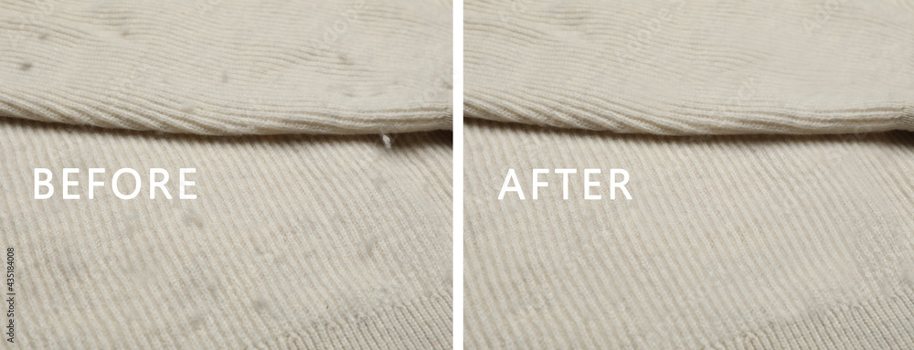 Light cloth before and after using of fabric shaver, collage. Banner ...