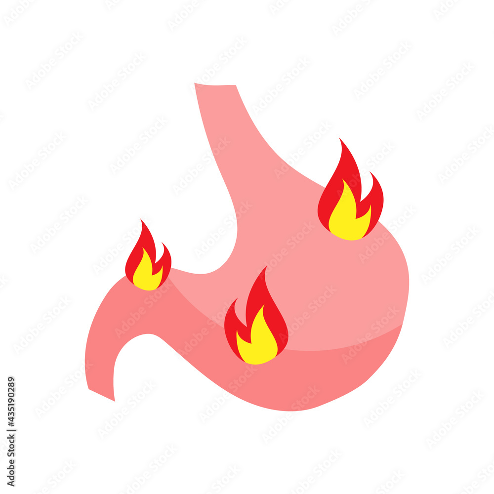 Heartburn. Stomach disease. Internal organ on fire. Gerd, gastric ulcer ...