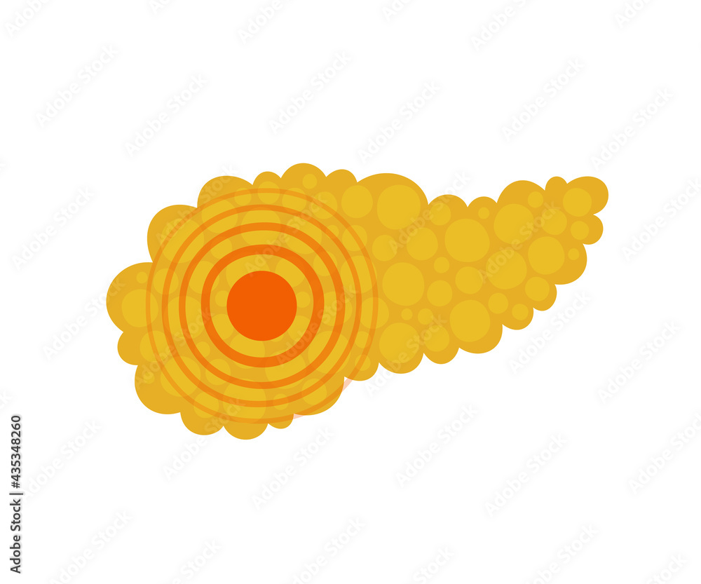 Pain in the pancreas. Sick pancreas. Pancreatitis attack. Isolated ...