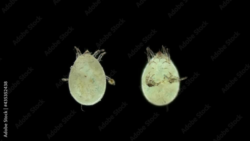 Soil mite of the Acaridae family under a microscope. saprophages feed ...