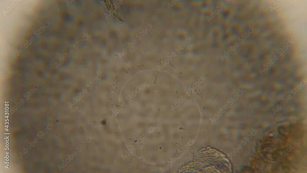 Bacteria Parasites and Worms in drinking Water under Microscope ...