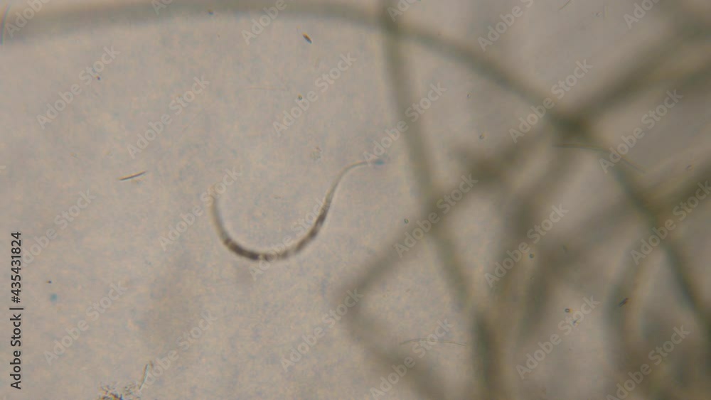 Bacteria Parasites and Worms in drinking Water under Microscope ...