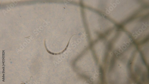 Bacteria Parasites and Worms in drinking Water under Microscope ...