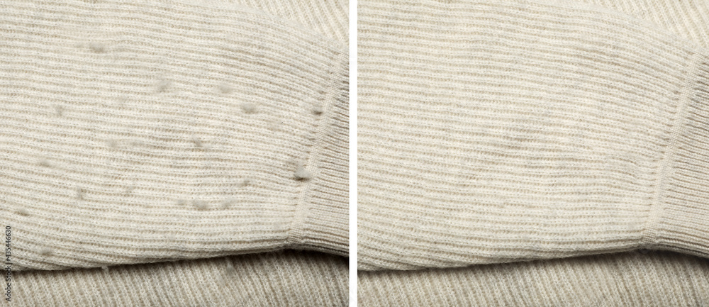 Light cloth before and after using of fabric shaver, collage. Banner ...