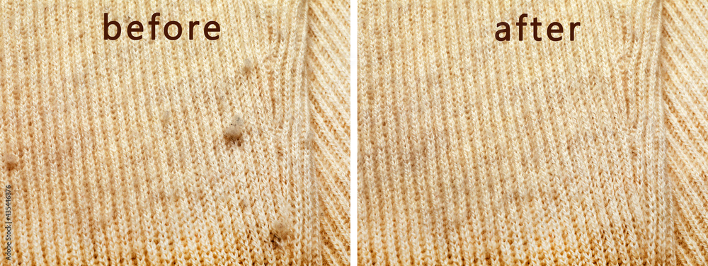 Light cloth before and after using of fabric shaver, collage. Banner ...