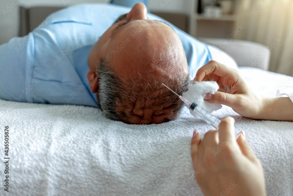 Man with hair loss problem receiving injection in head by young female ...