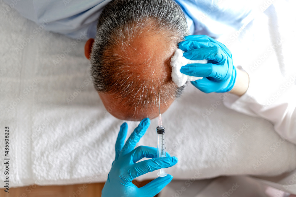 Man with hair loss problem receiving injection in head by young female ...
