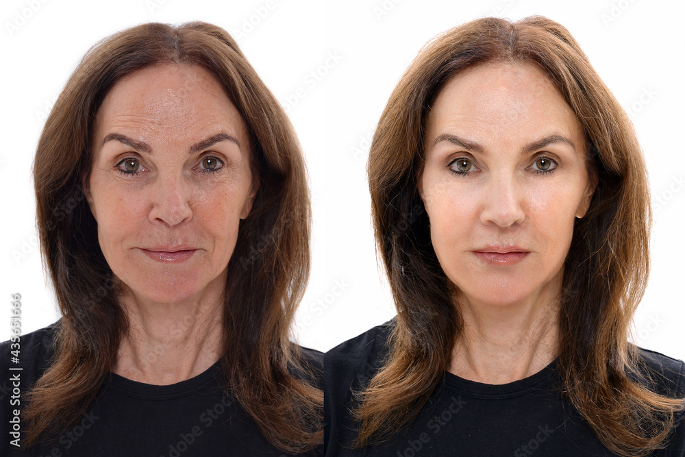 Fotografia do Stock: frau, schön, portrait, gesicht, haut retuschiert ...