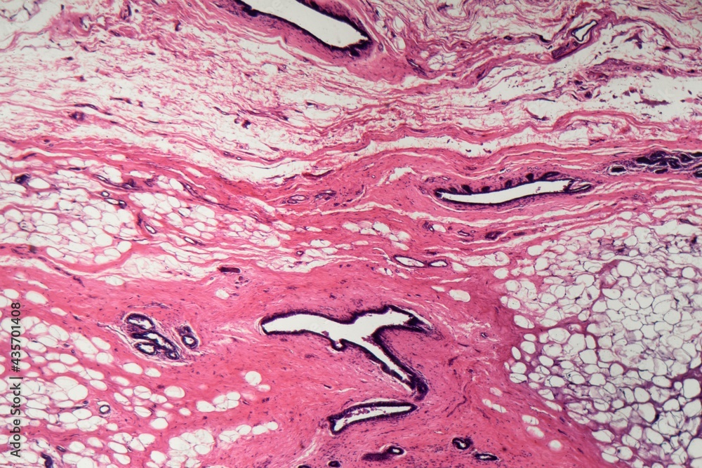 Human mammary gland cells under the microscope Stock Photo | Adobe Stock