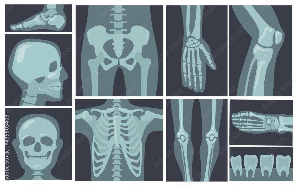 X-ray shots of human body. Cartoon vector illustration. X-rays of ...