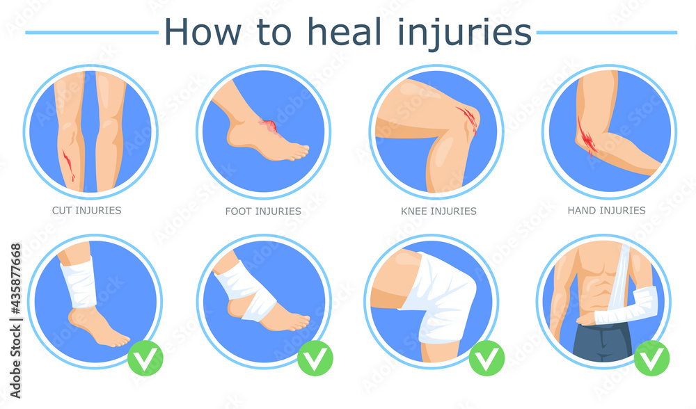 Vetor de Healing of different injuries poster. Cartoon vector ...