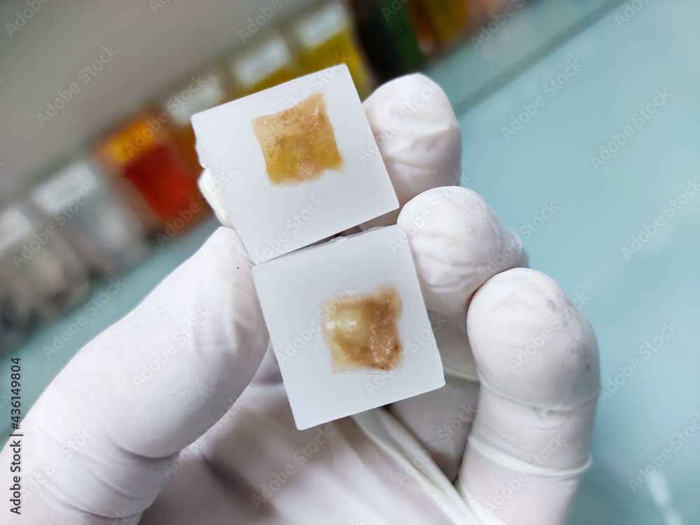 Paraffin Embedded Tissue Blocks of Cancer on isolated White Background ...