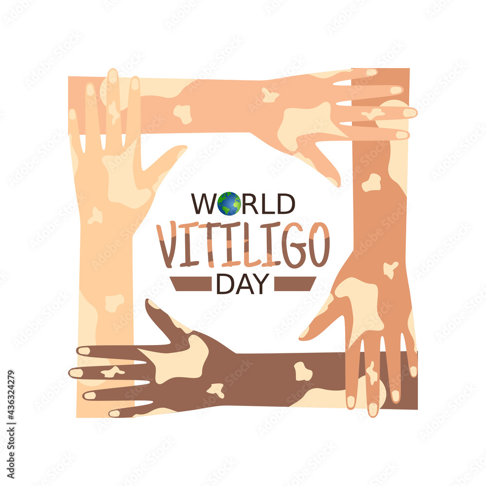Vetor de vector graphic of world vitiligo day good for world vitiligo ...