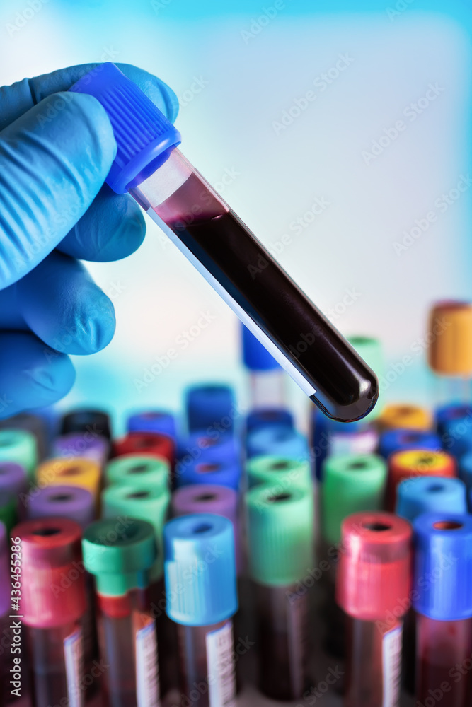 Foto de Technician working with blood tube sample for testing in the ...