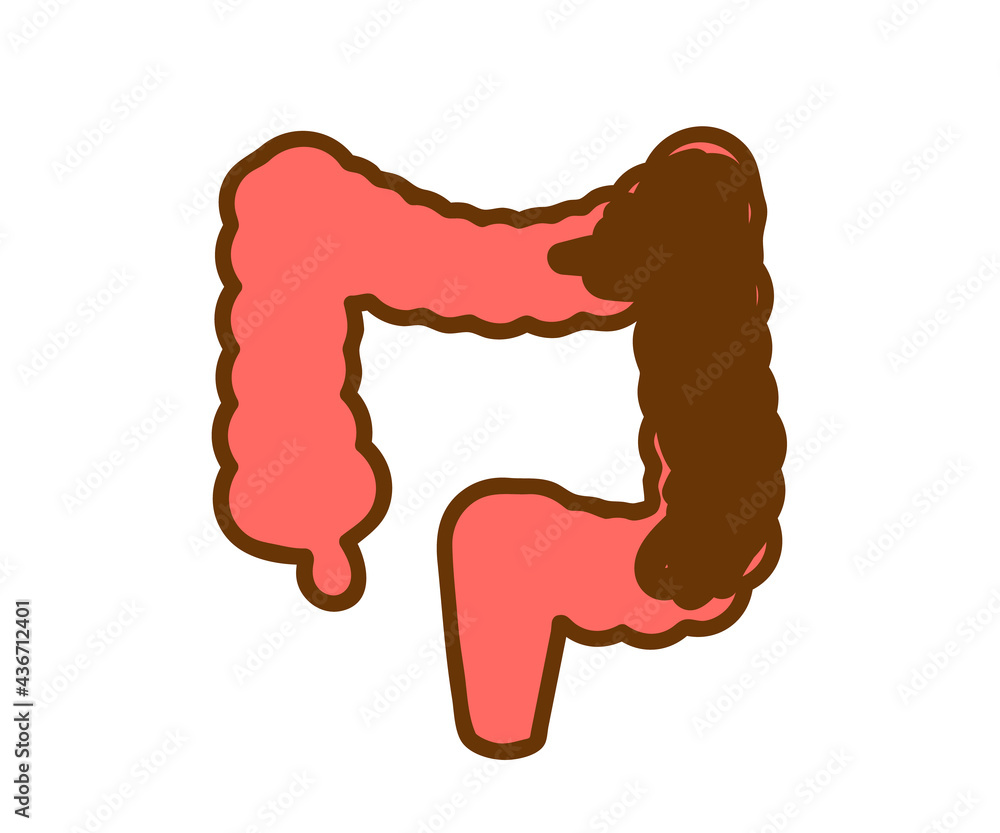 Large intestine on a white background. Feces. Vector illustration ...