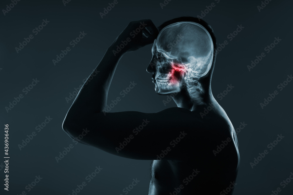 X-ray of a man's head. Medical examination of head injuries. Jaw joint ...