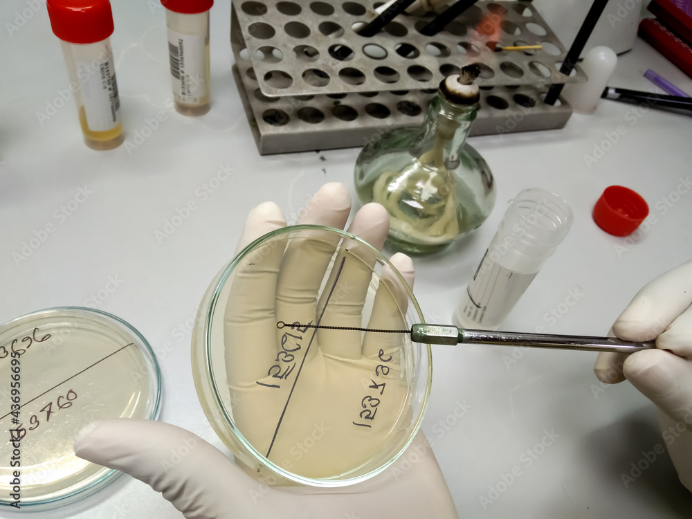 Foto de Scientist hold a petri dish at one hand and other hand hold a ...