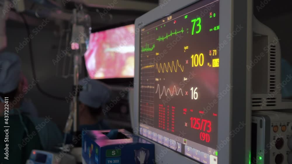 High-tech medical equipment monitors the indicators of the state of the ...