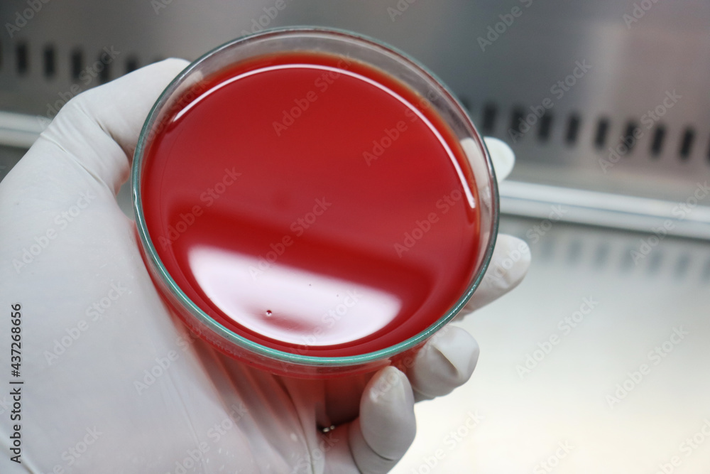 blood culture media for microorganisms identification Stock Photo ...