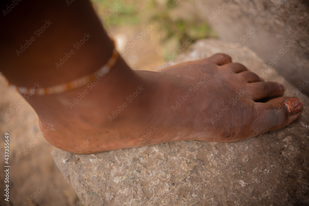 Zambian, African Dirty girl’s feet, poor girl life style, real need ...