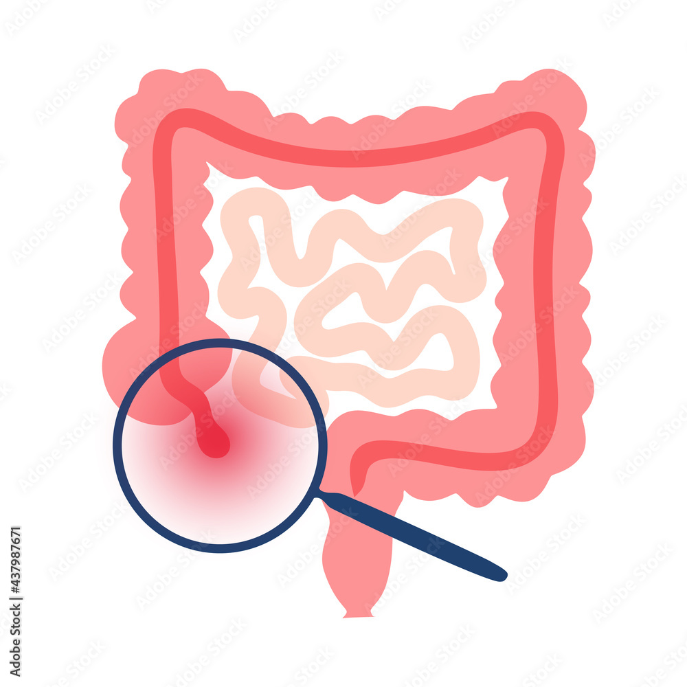 Appendix pain concept Stock Vector | Adobe Stock