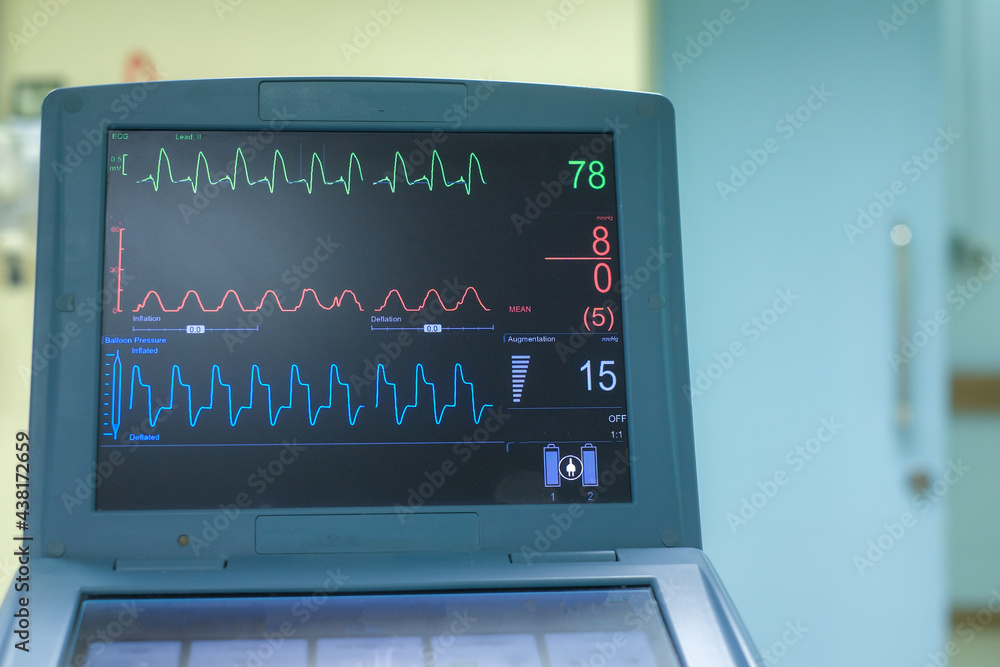 EKG monitor in intra aortic balloon pump machine. Medical equipment ...