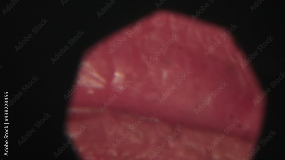 Video „Teeth enlargement, view through the eyepiece. Observation of the ...
