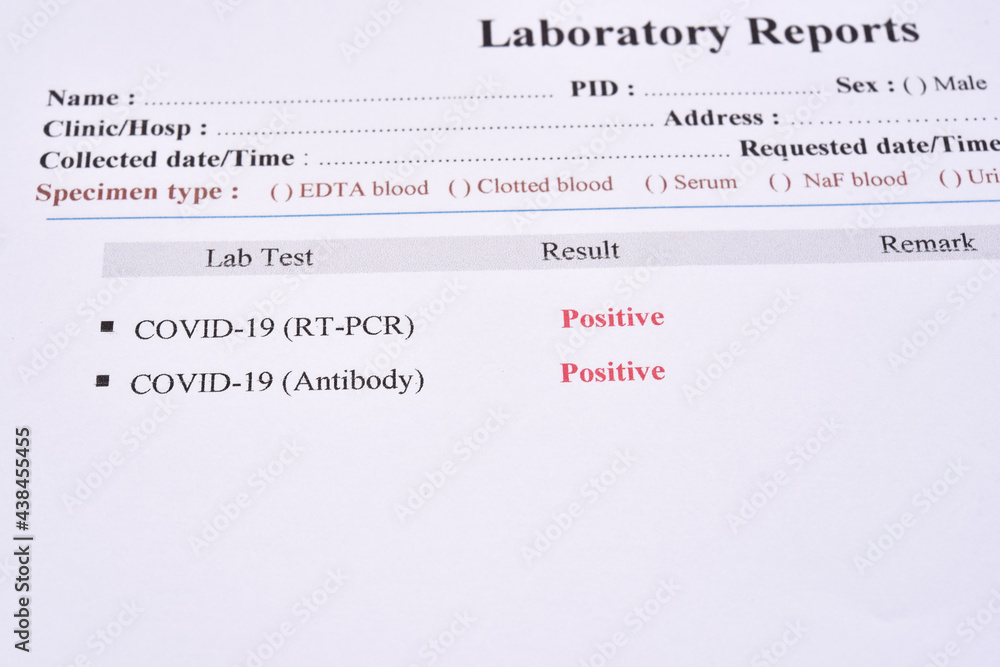 COVID-19 test results by using RT-PCR method and rapid test antibody ...