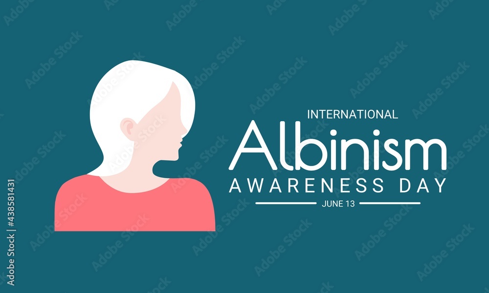 Vector illustration of albino woman, as a banner, poster or template ...