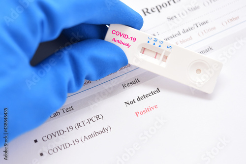 COVID-19 negative result by RT-PCR method but positive result by rapid ...