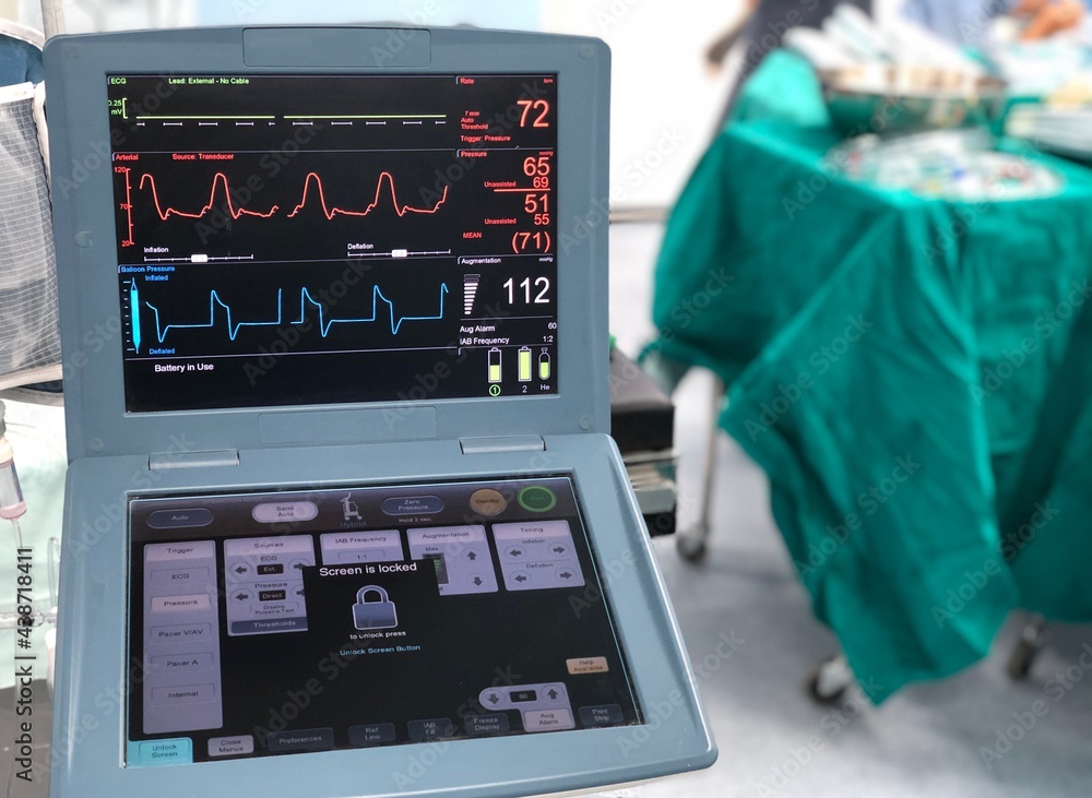 Intra aortic balloon pump (IABP) machine in operating room. Stock Photo ...