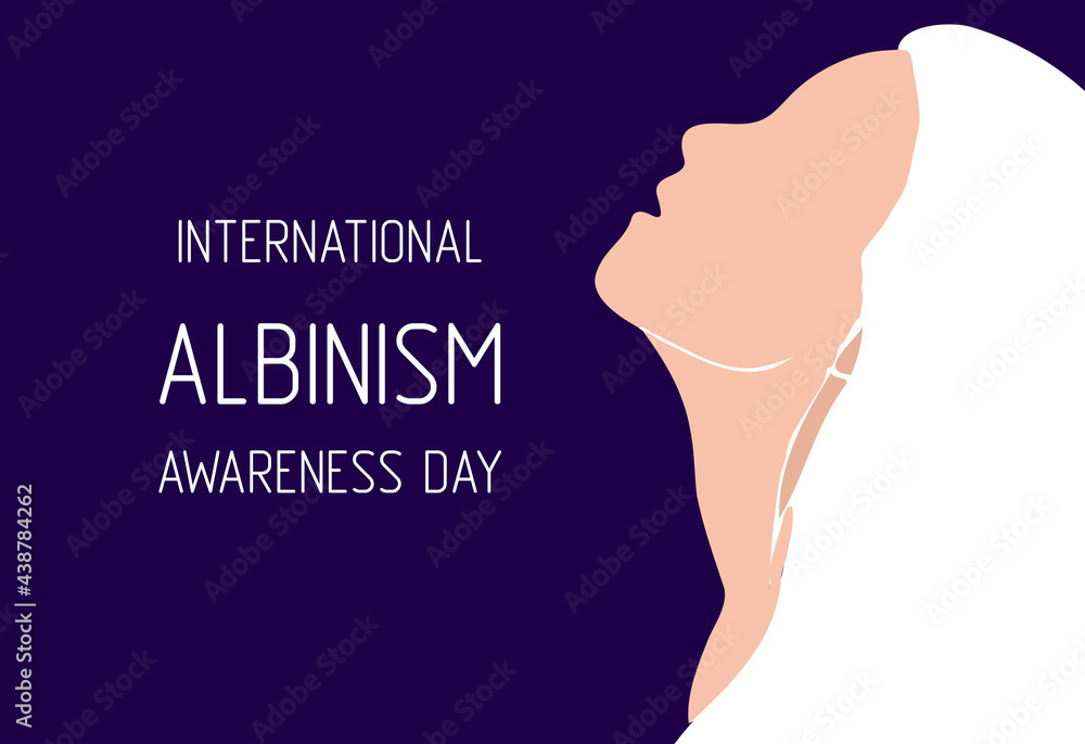 International Albinism Awareness Day, woman with white hair, pale skin ...