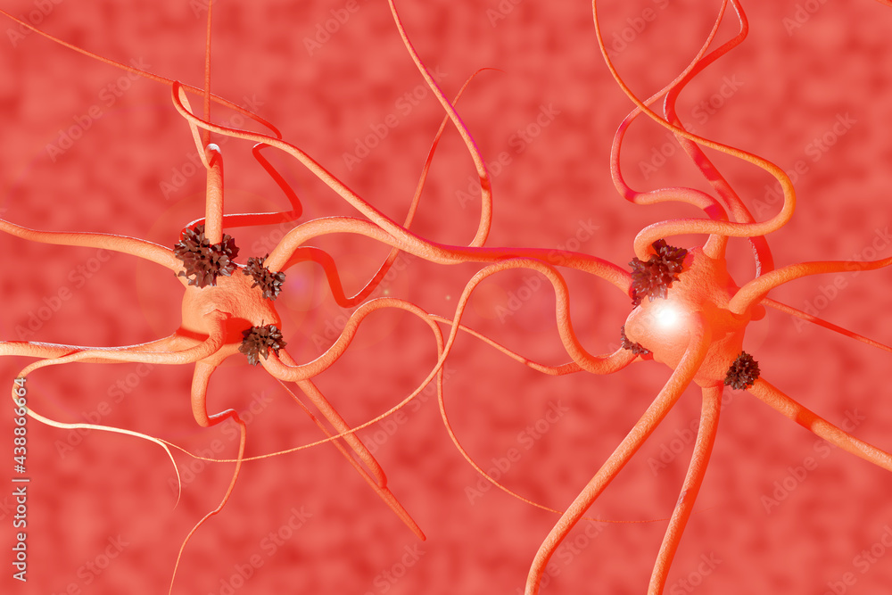 Damage to brain neurons in Parkinson's disease. Synapses of neurons ...