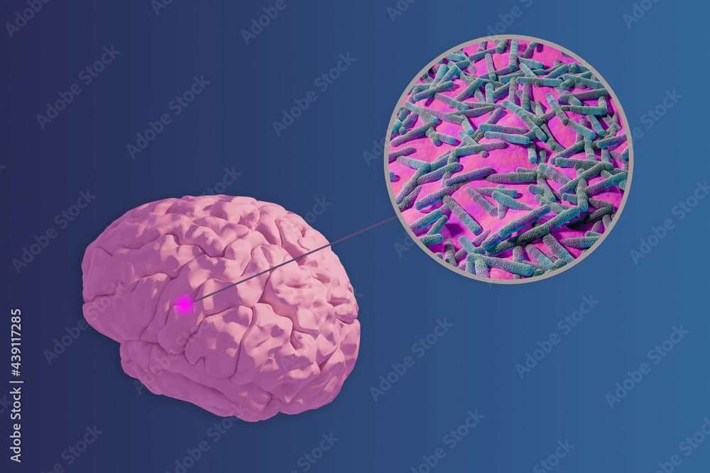 Pathogens that enter the human brain with blood and cause disturbances ...