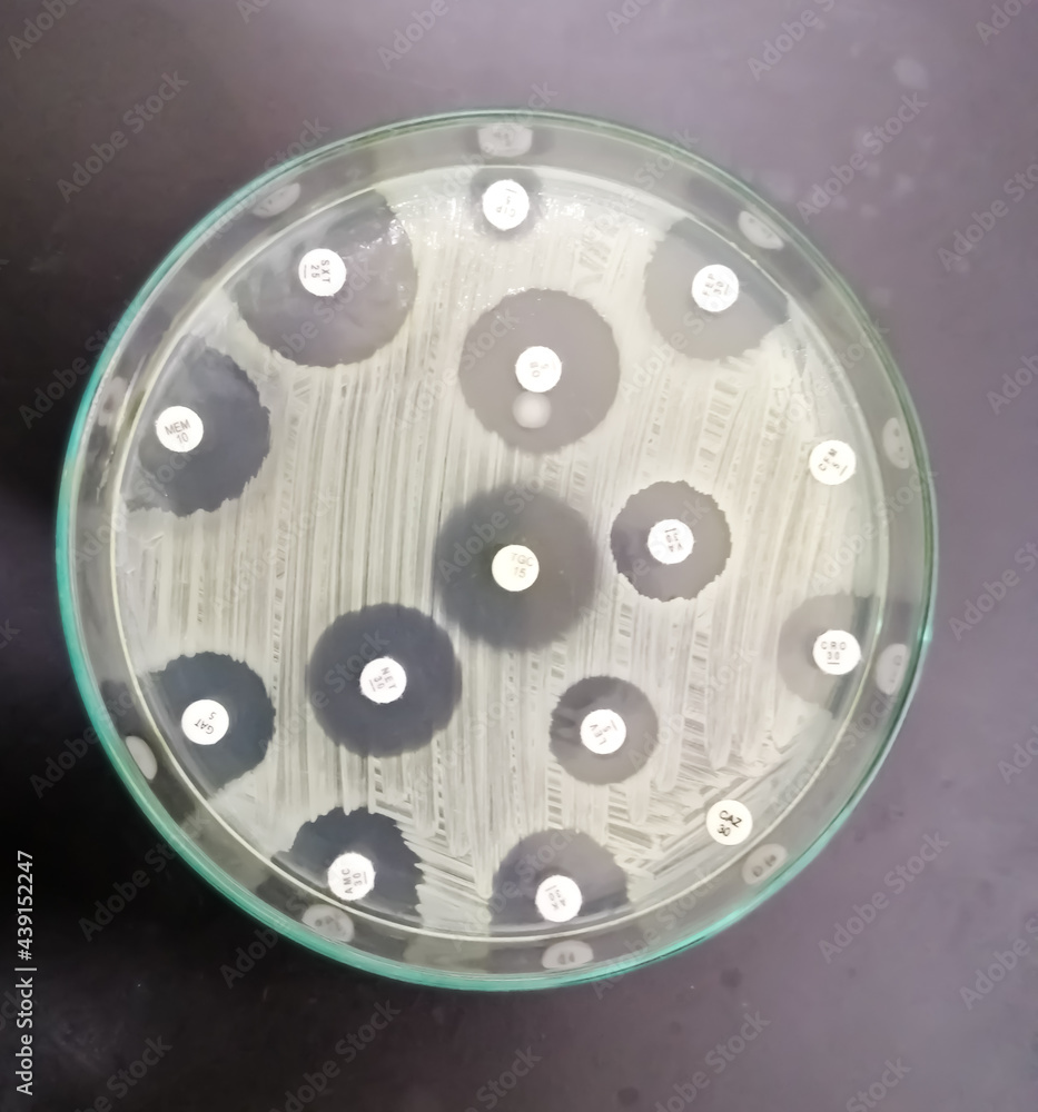 Antimicrobial susceptibility testing in culture plate. Susceptibility ...