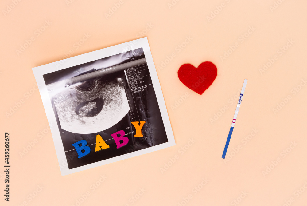 A positive pregnancy test strip, an ultrasound image of the fetus, a ...