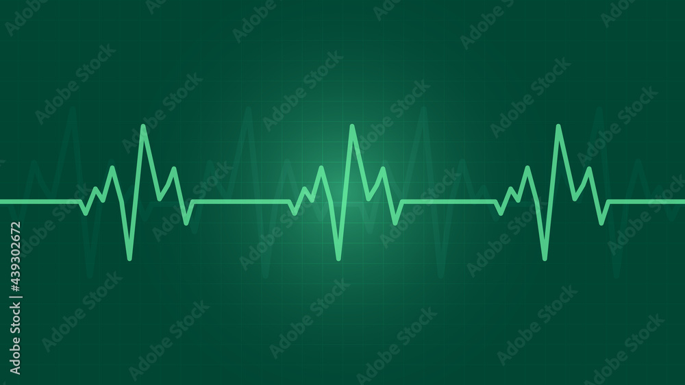 Heartbeat diagram, heart rate chart, pulse vector stock illustration ...