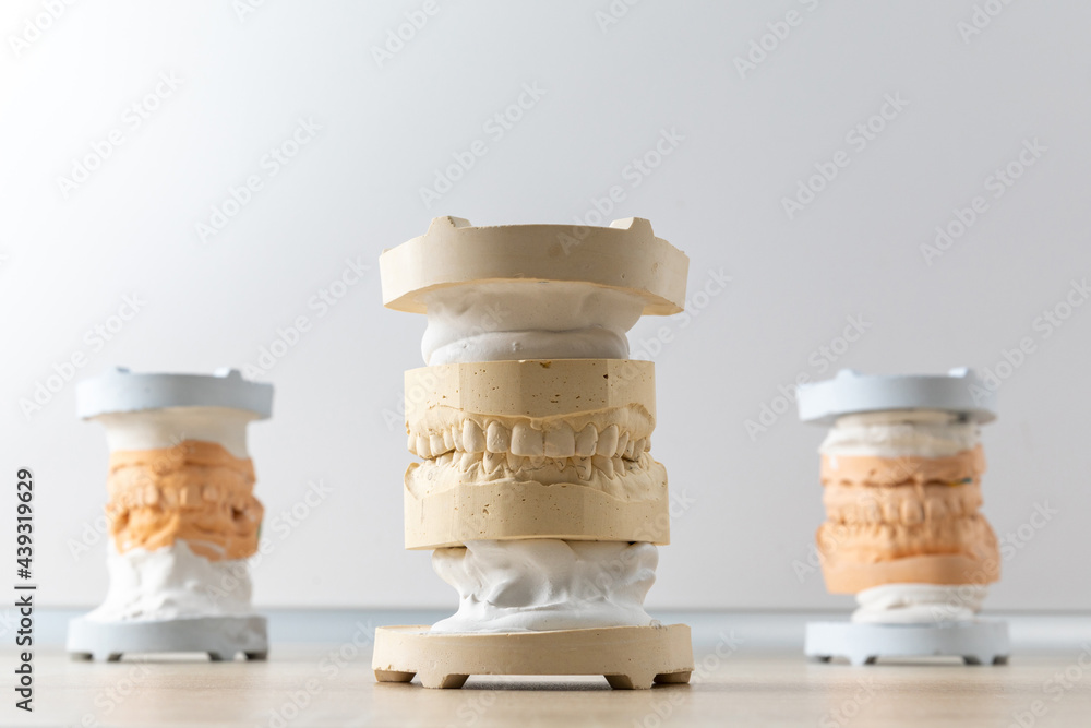 Dental model of human teeth made of gypsum. dental impression Stock ...