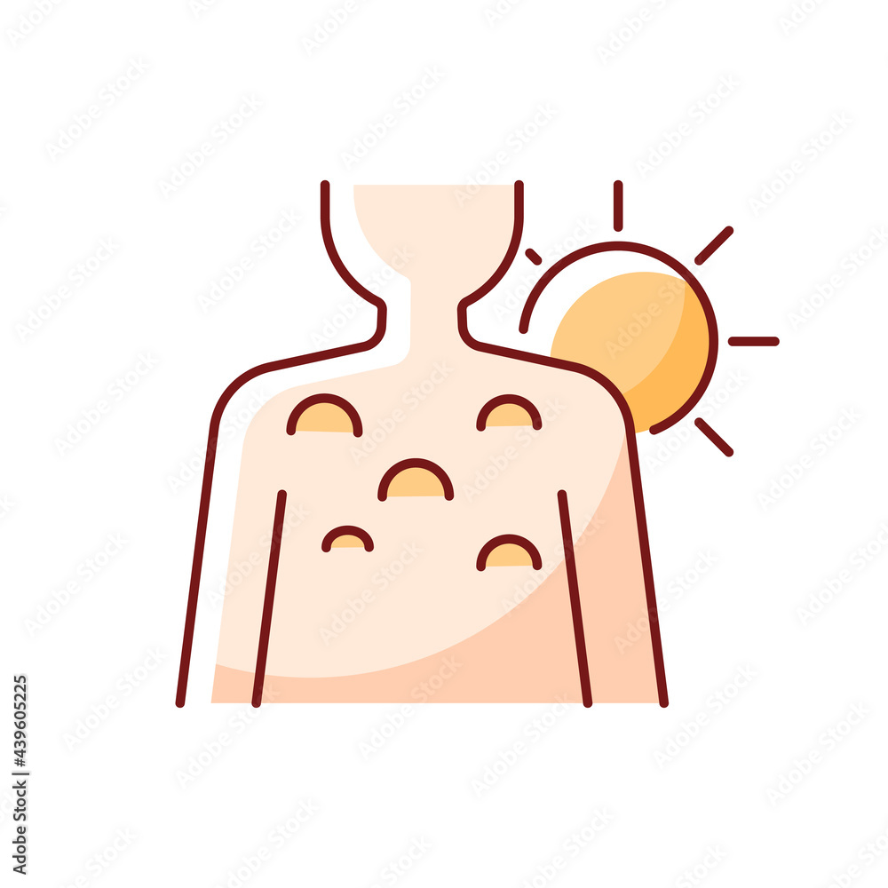Fluid filled blister RGB color icon. Sunburn bumps on body from sun ...