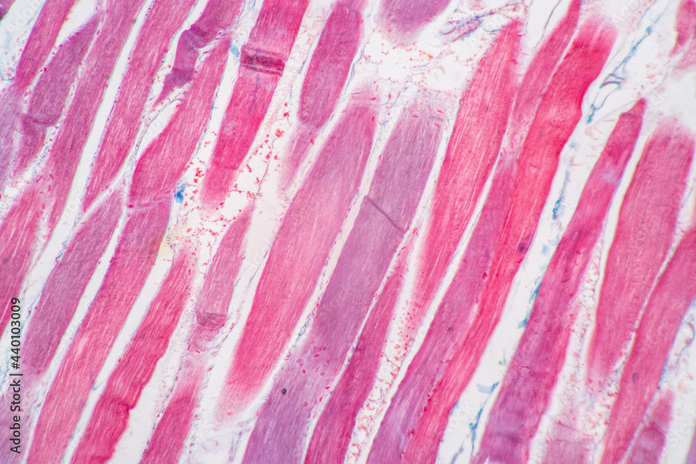 Characteristics of anatomy and Histological sample Striated (Skeletal ...