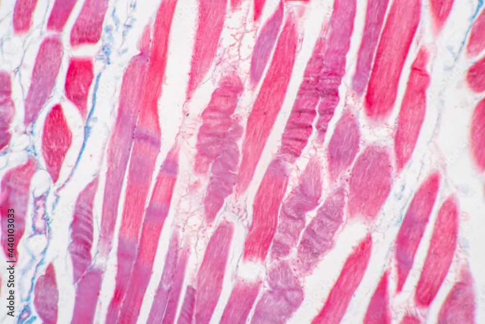 Characteristics of anatomy and Histological sample Striated (Skeletal ...