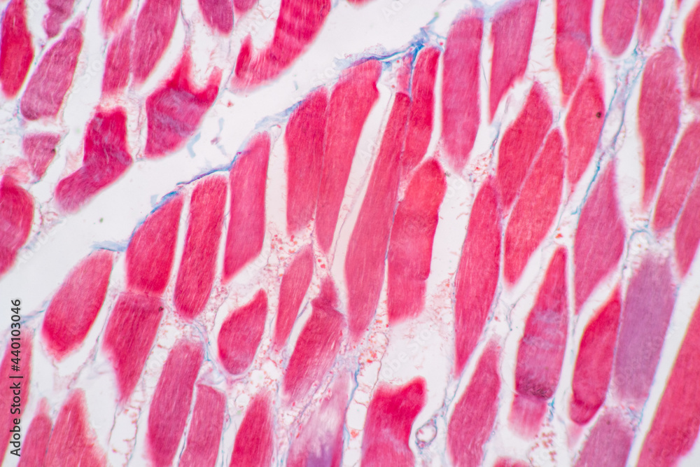 Characteristics of anatomy and Histological sample Striated (Skeletal ...