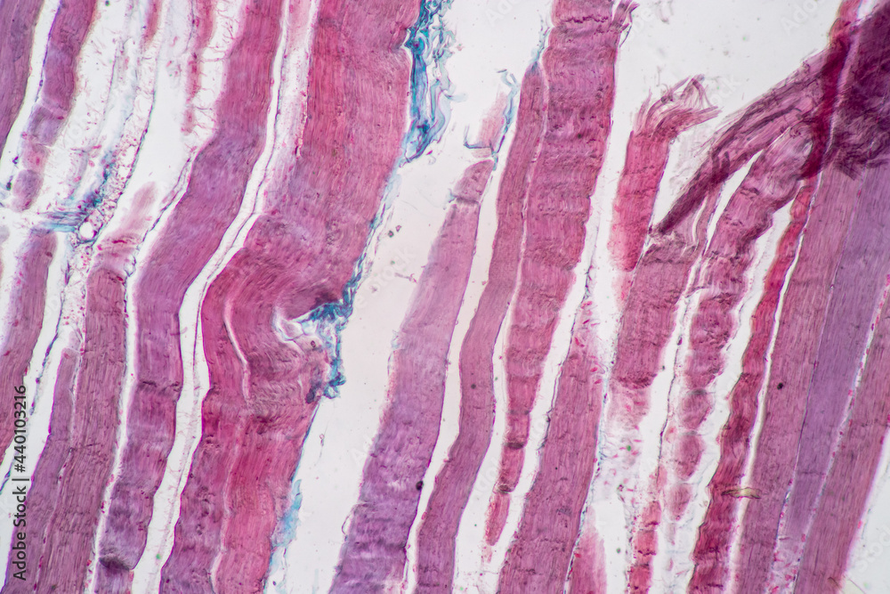 Characteristics of anatomy and Histological sample Striated (Skeletal ...