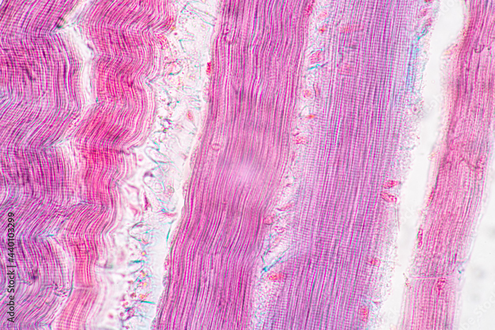 Characteristics of anatomy and Histological sample Striated (Skeletal ...