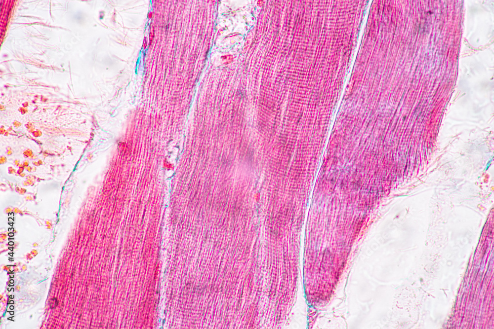 Characteristics of anatomy and Histological sample Striated (Skeletal ...