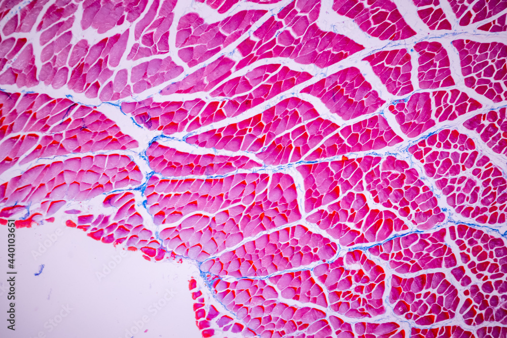 Characteristics of anatomy and Histological sample Striated (Skeletal ...