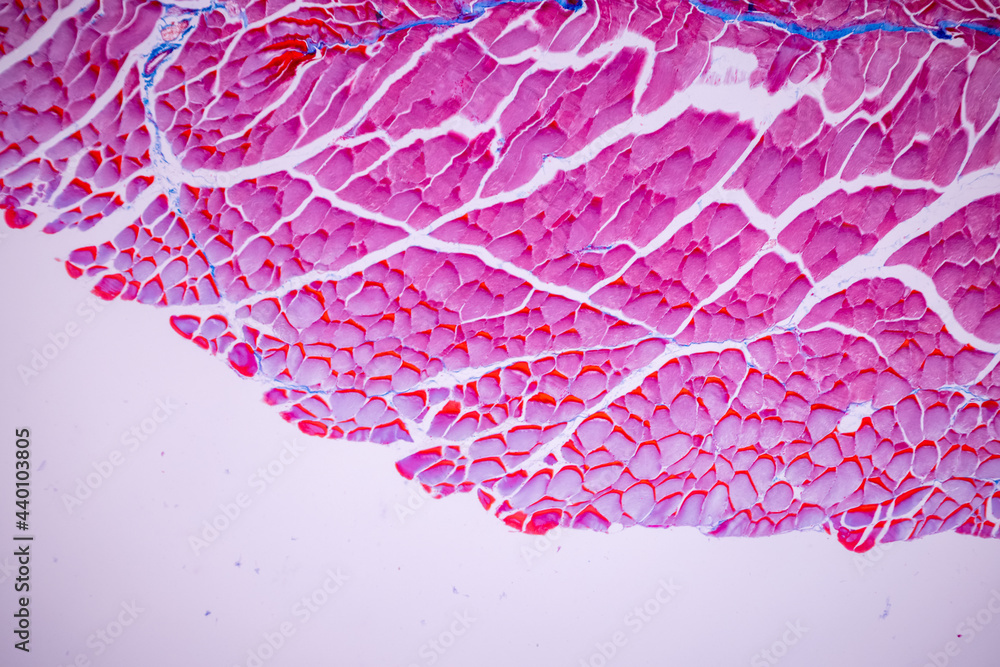 Characteristics of anatomy and Histological sample Striated (Skeletal ...